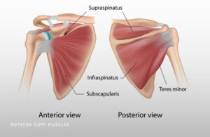 Rotator Cuff Tear Schaumburg - Thomas Obermeyer, MD